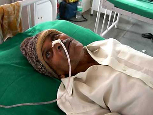 Bệnh Bò điên: Nguyên nhân, biến chứng và cách điều trị